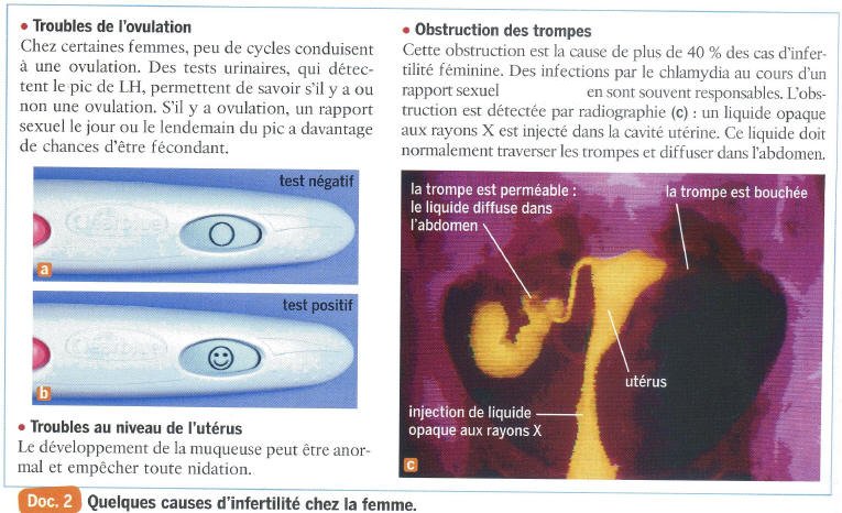 L'infertilité féminine